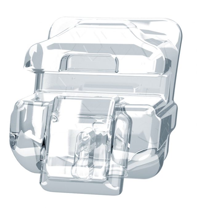 Pasang Kawat Gigi Damon | Damon Bracket System | Joy Dental