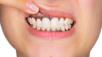 5 Penyebab Gusi Menghitam Yang Perlu Diketahui | Joy Dental